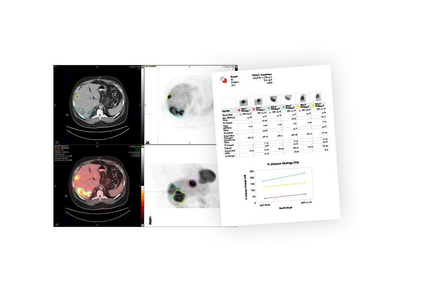 MIM Encore® | A Comprehensive Solution for PET and Nuclear Medicine