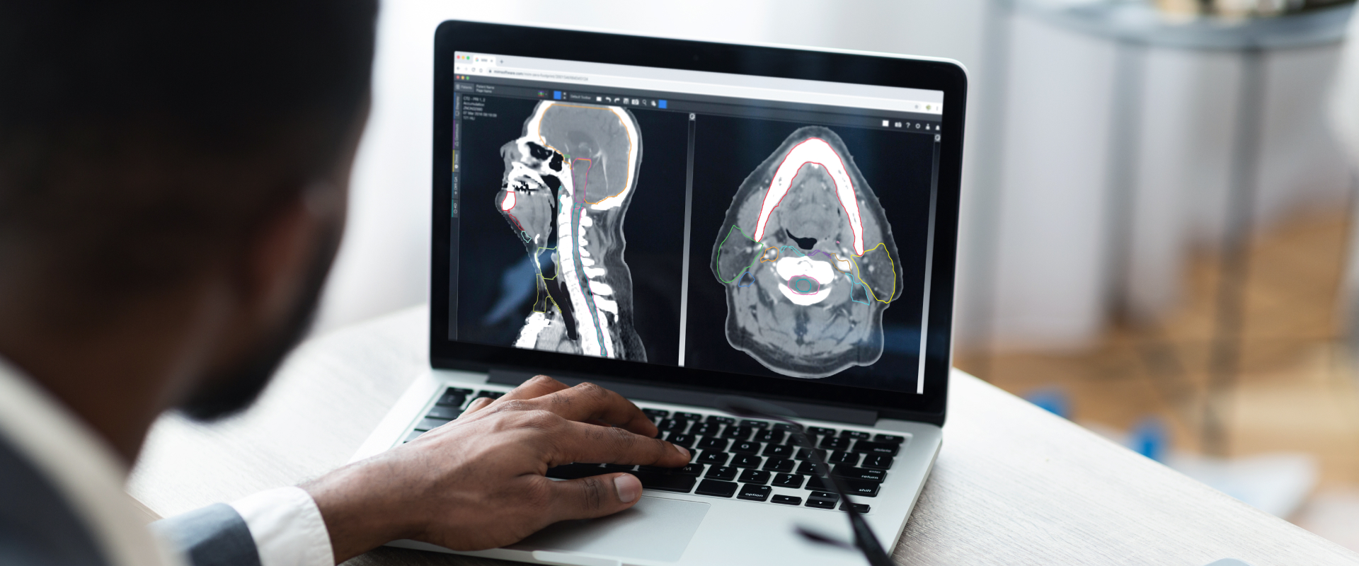 Remote Access | MIM Software